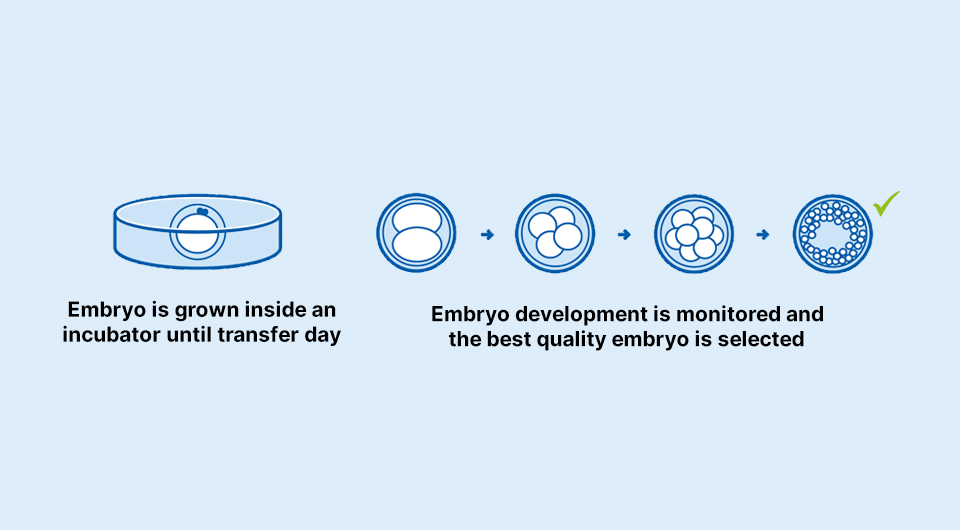 EmbryoScope time-lapse system - Vitrolife