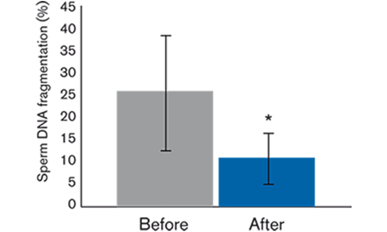 Sperm preparation - Vitrolife
