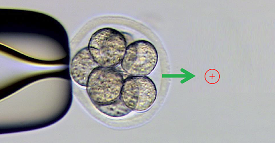Octax Laser & imaging systems - Vitrolife