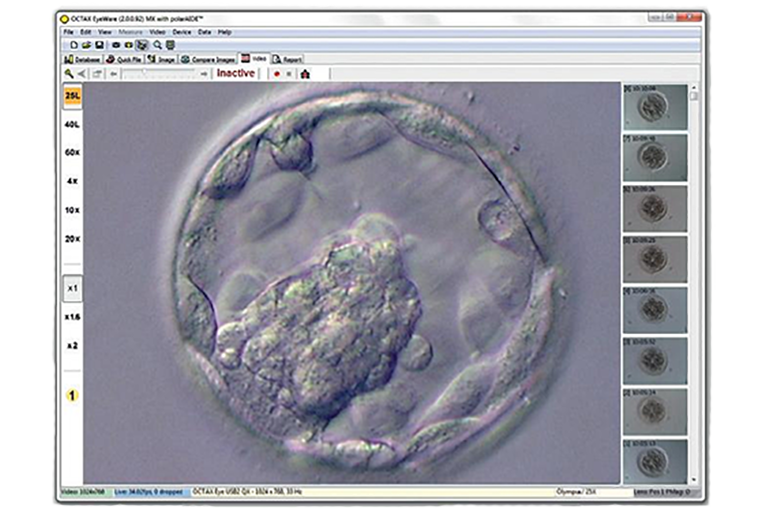 Vitrolife - Octax Laser & imaging systems