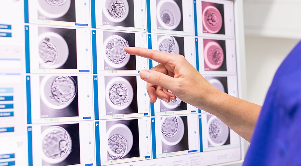 Vitrolife - EmbryoScope+ time-lapse system Vitrolife - EmbryoScope+ time-lapse system