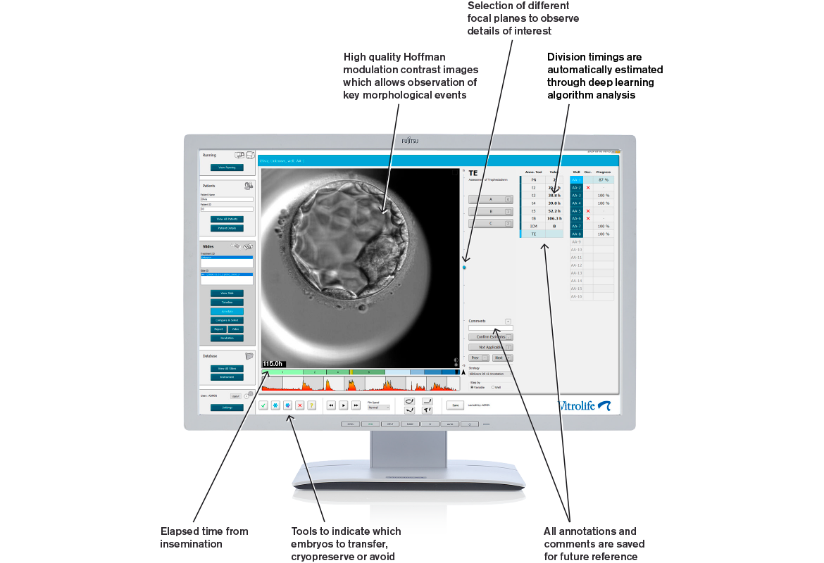 Embryo decision support tools - Vitrolife