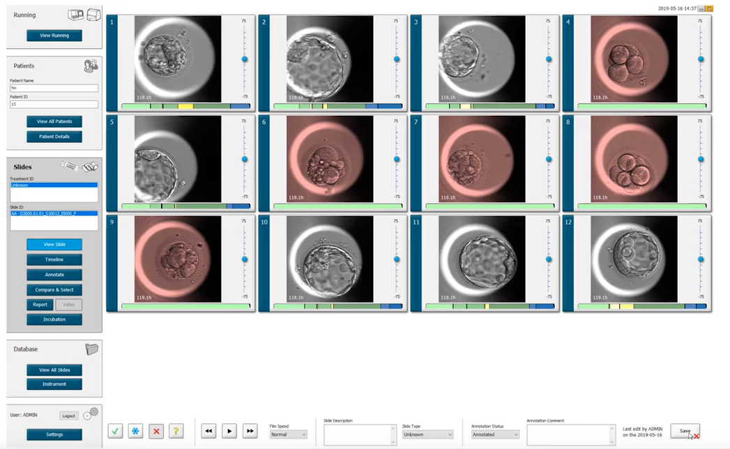 Time-lapse - Vitrolife
